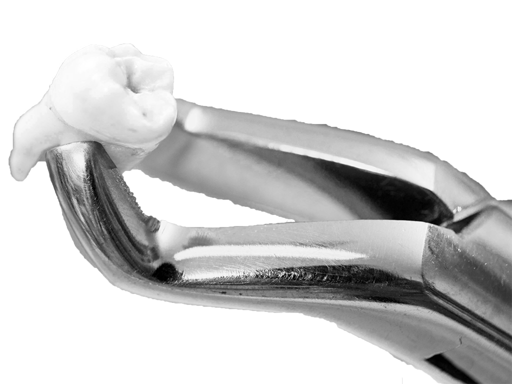 Tooth Extractions Post Op Oral Surgeon In Marietta GA Tooth Extractions Post Op Oral Surgeon In Marietta GA